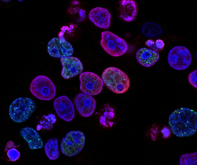 Carvykti: Second FDA-Approved CAR T-cell Therapy for Relapsed ...